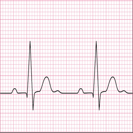 Prof Neil Ruparelia | ECG