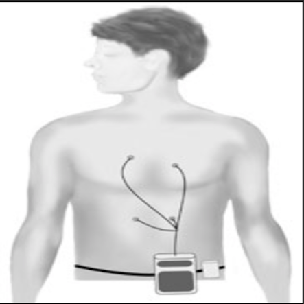Prof Neil Ruparelia | Cardiac investigations